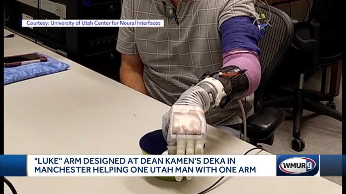'LUKE' arm designed by Dean Kamen helping Utah man