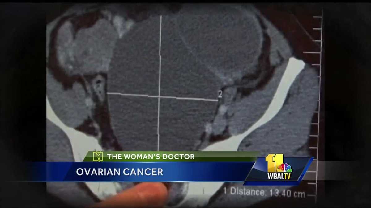 Video: Don't overlook these signs of ovarian cancer