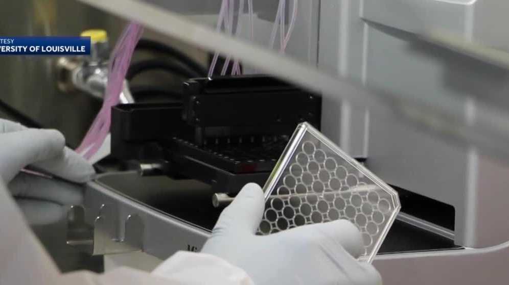 UofL lab tests thousands of COVID-19 samples, plans to expand