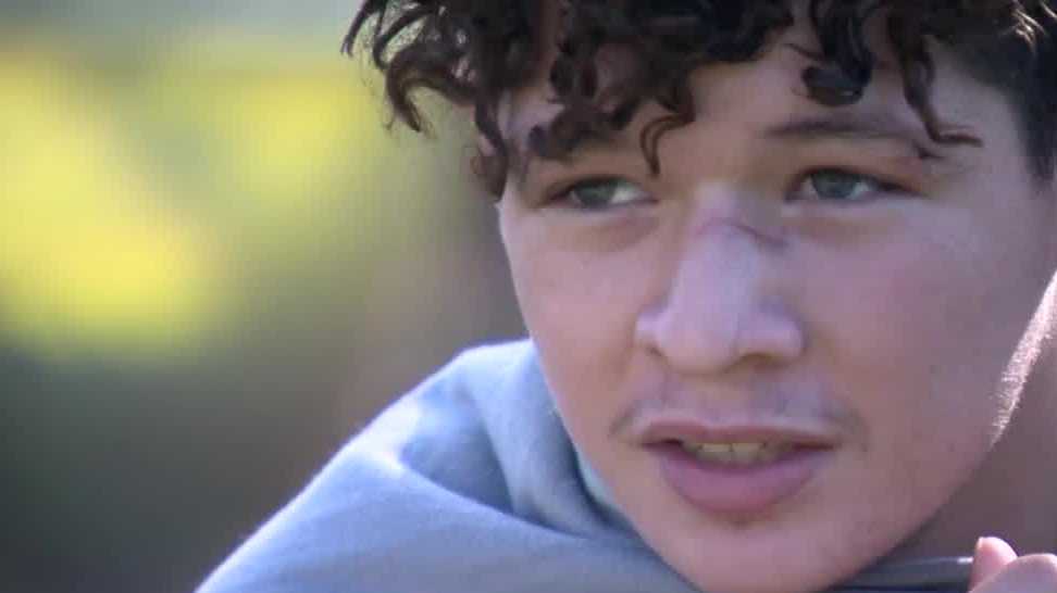 Turlock teen stabbed 23 times recalls day of attack, his road to recovery