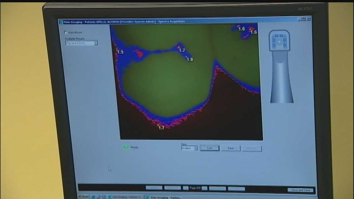 New technology changing way cavities are found, treated
