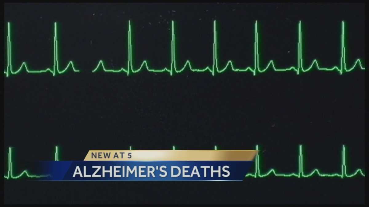 Alzheimer's in U.S. is sixth-leading cause of death