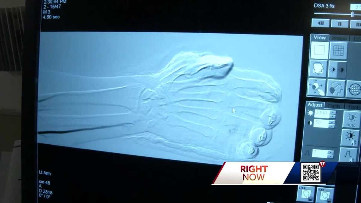 Kansas City doctor urges caution amid frigid temps