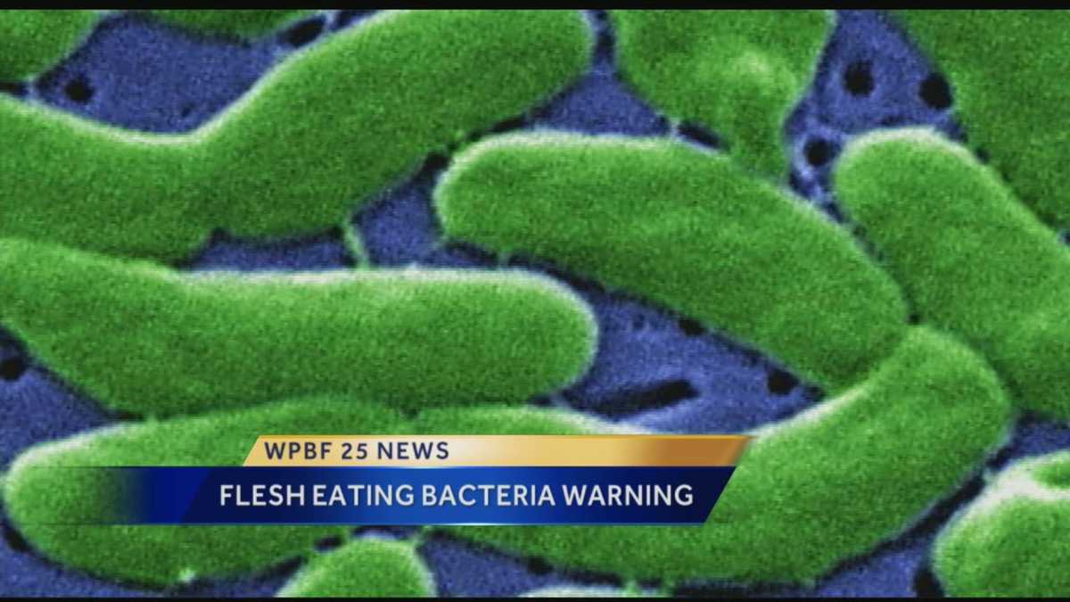 Threat to Florida beachgoers: Deadly bacteria in saltwater