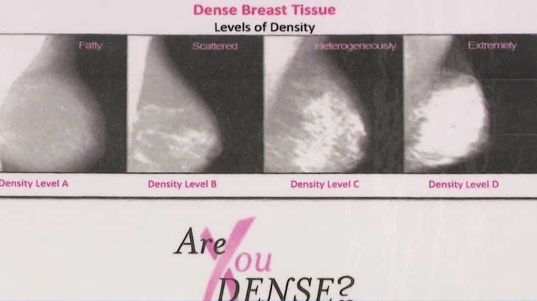 Omaha business provides mammogram alternative