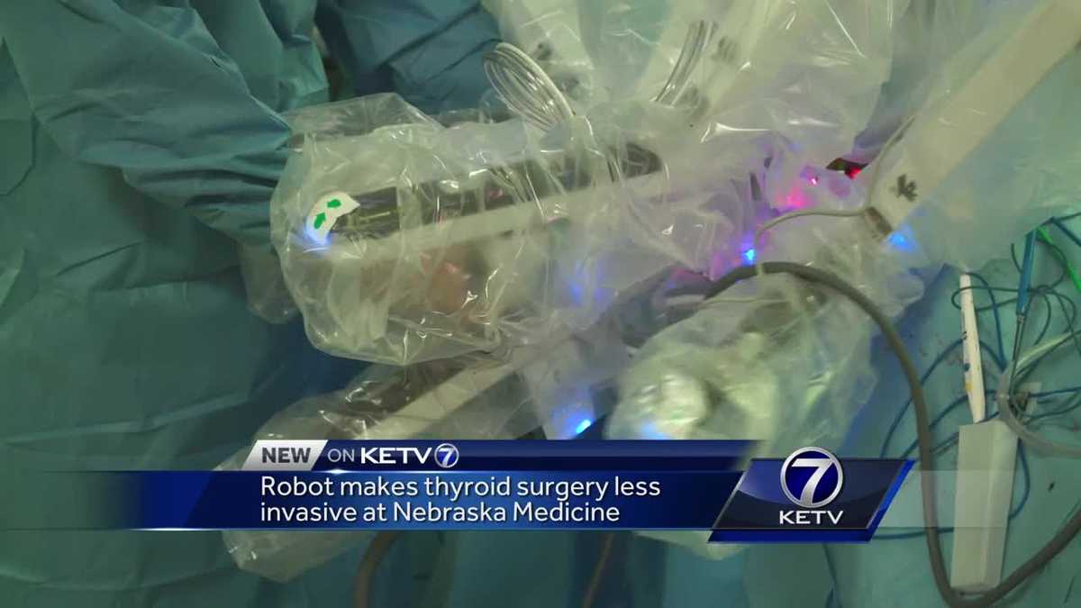 Robot makes thyroid surgery less invasive at Nebraska Medicine
