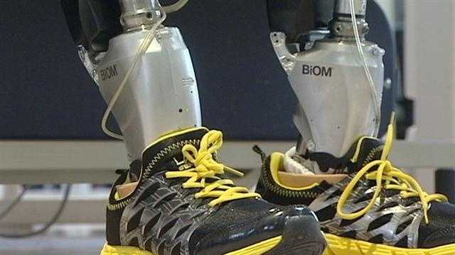 Quad amputee ready to hit hiking trails with robotic legs