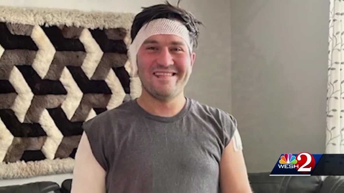 New Smyrna Beach Utilities worker electrocuted, saved by nurse