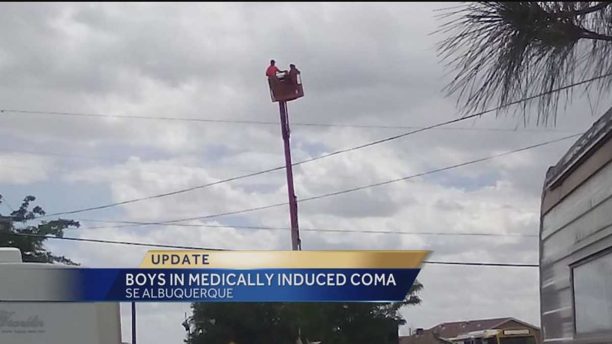 Boys in medically-induced coma after fall