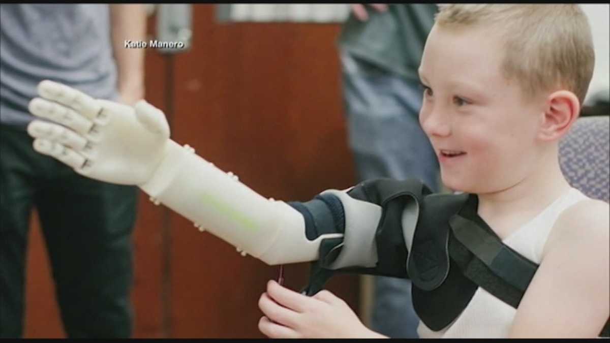 Students on budget make bionic arm for boy