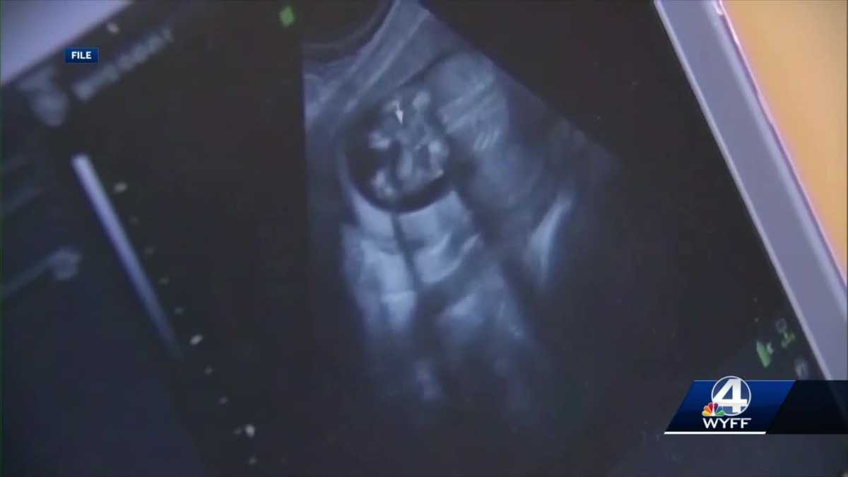 Columbia: S.C. House to vote on near-total ban on abortion