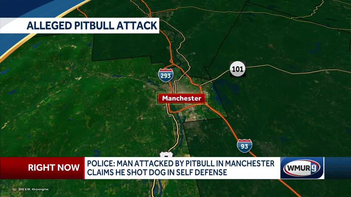 Police: Man allegedly attacked by pit bull in Manchester