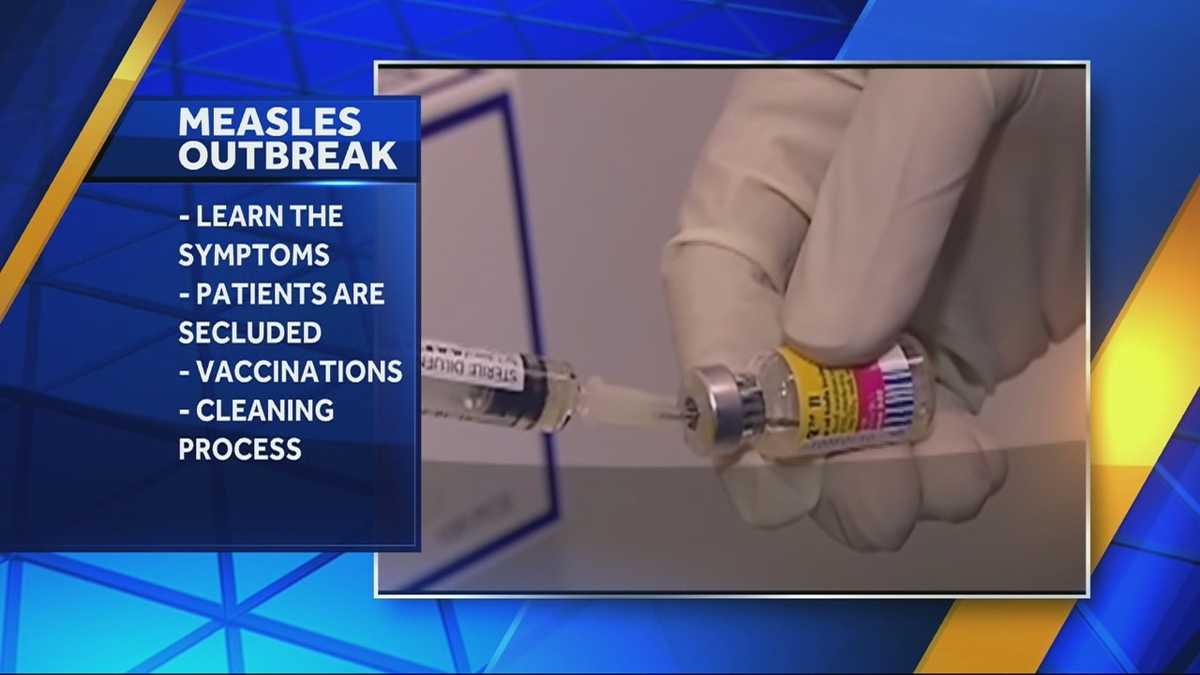 Doctors want public's help to contain measles cases