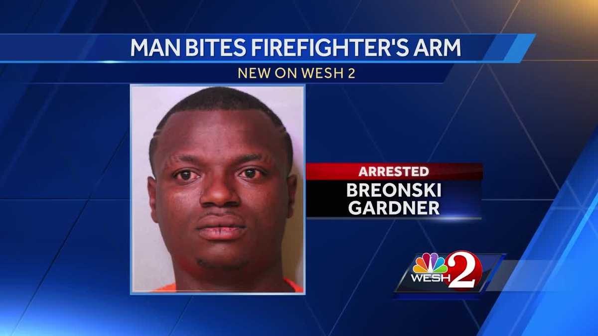 Man accused of biting firefighter's arm