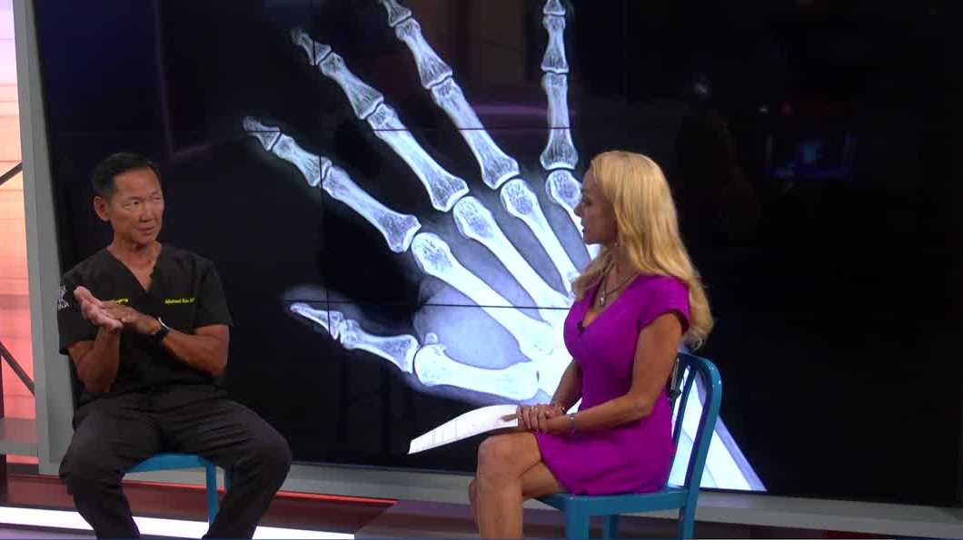Treating common hand conditions with Dr. Kim
