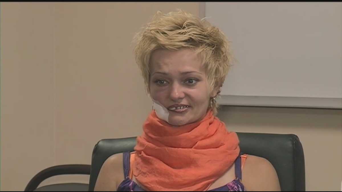 UofL doctors plan to live tweet Lessya Kotelevskaya’s surgery