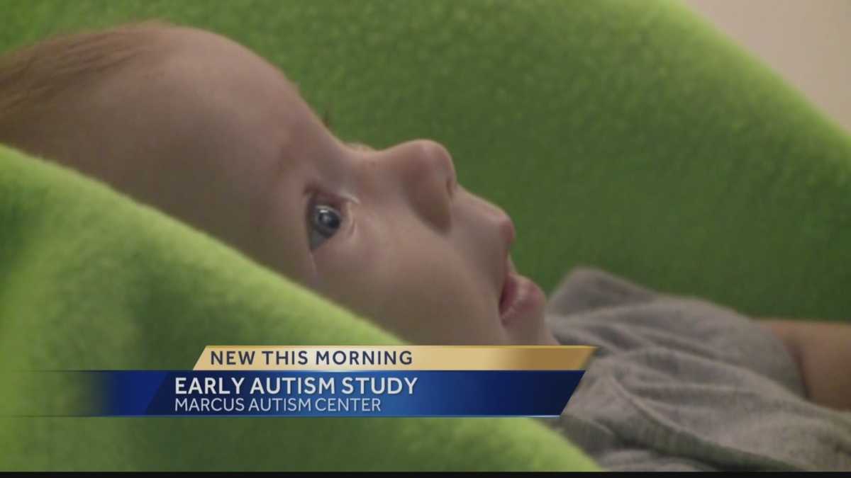 Baby's eye movements may be early indicator of autism