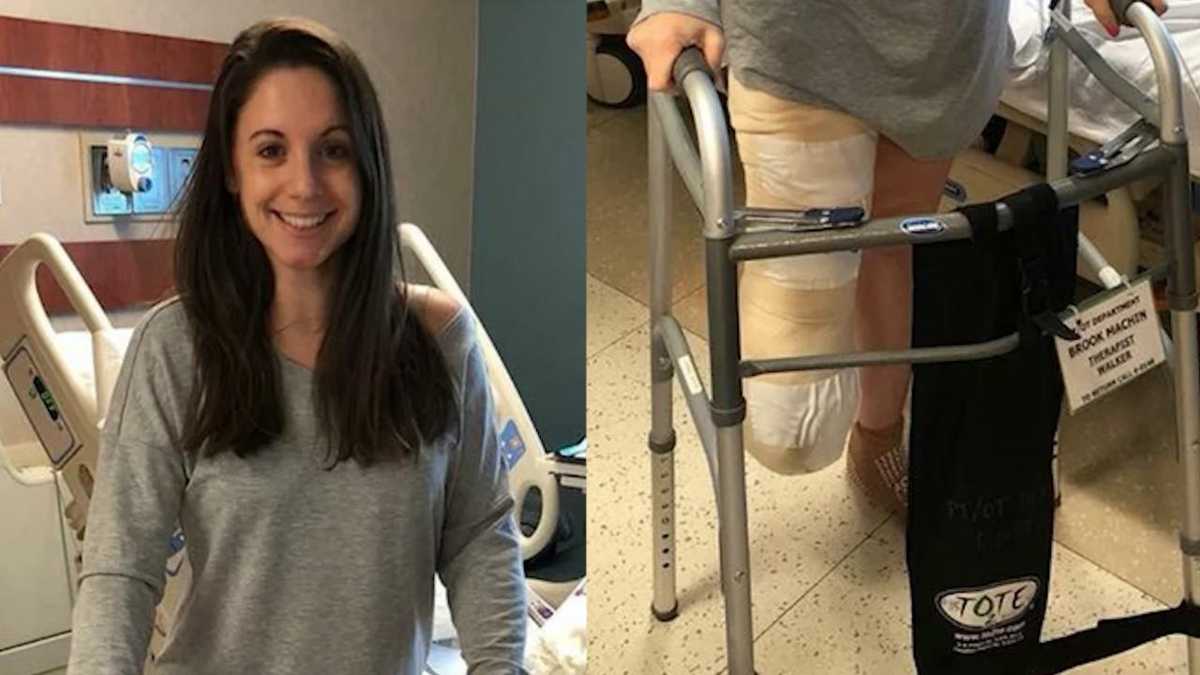 Mom has foot amputated after discovering tumor during pedicure