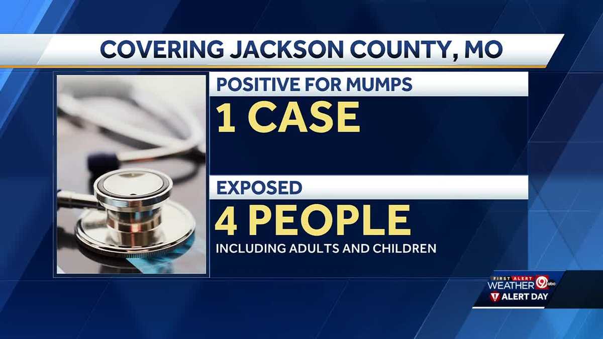 Eastern Jackson County resident tests positive for the mumps