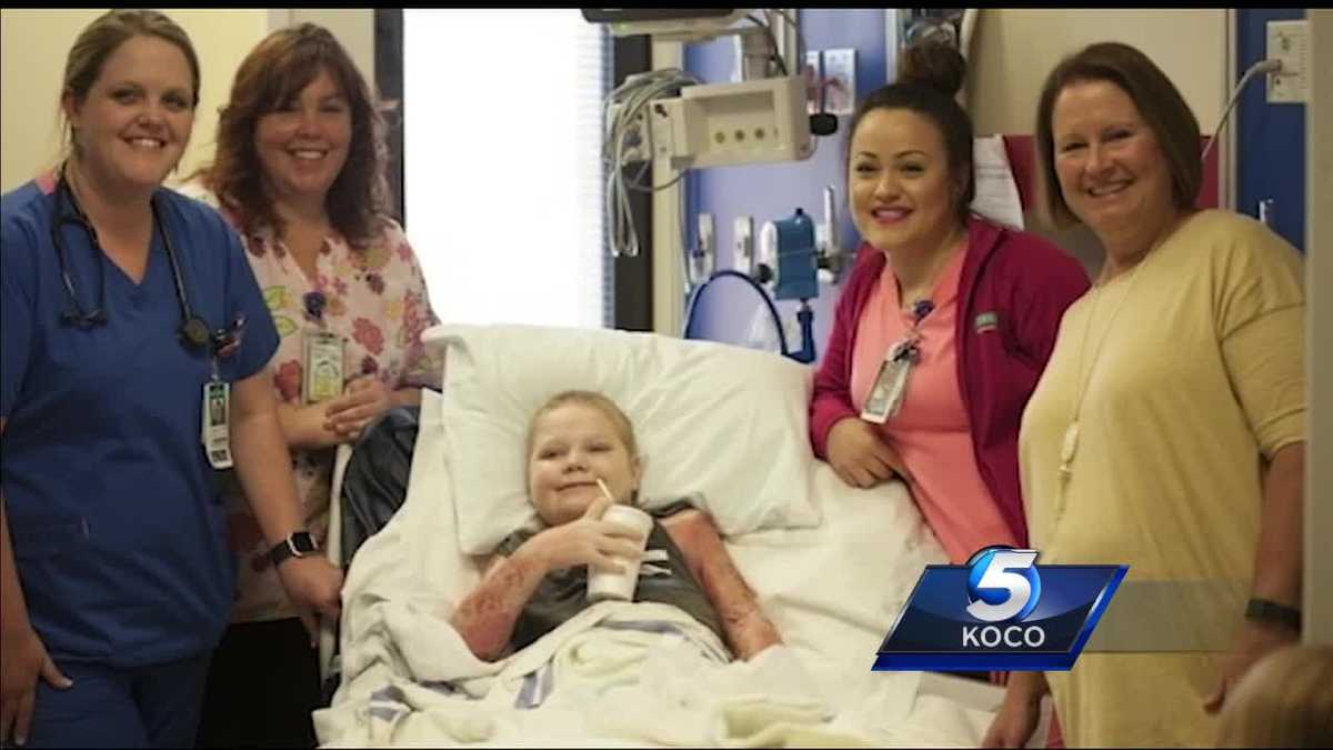 8 months later, 10-year-old burn victim finally returns home