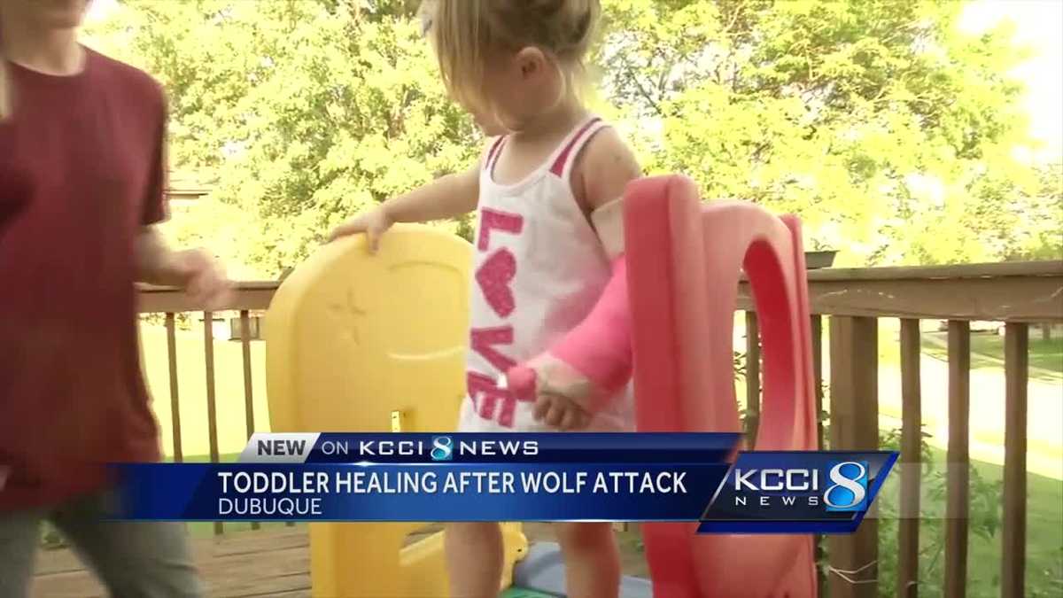 Iowa toddler recovering after wolf attack