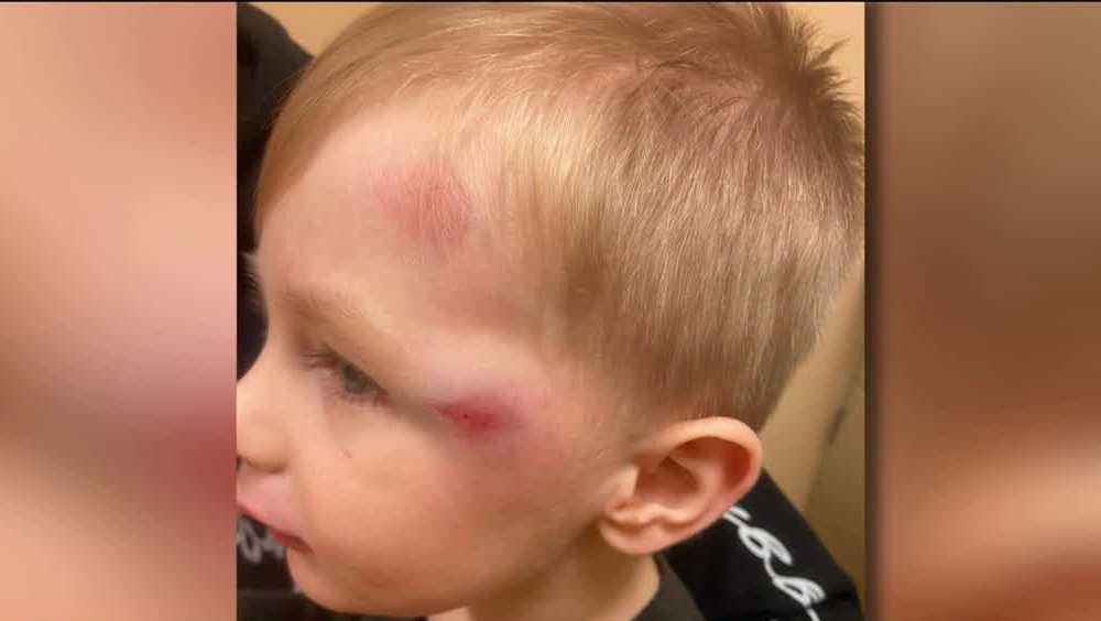 Butler child struck by car while Halloween trick-or-treating