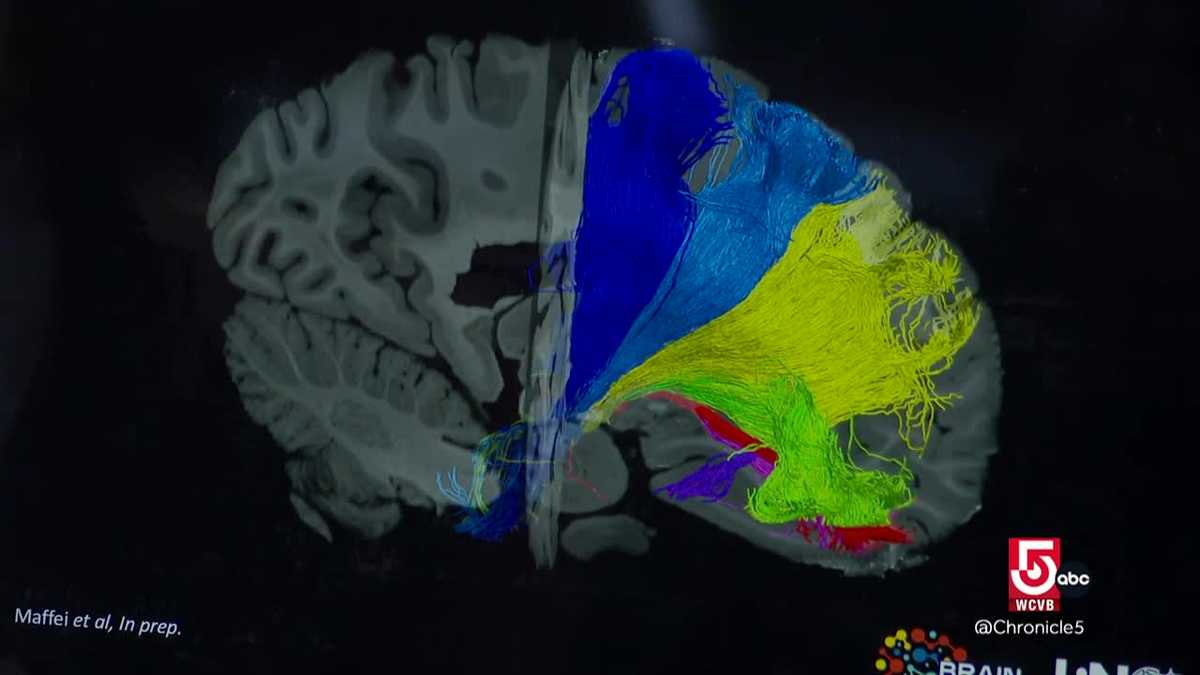 Mapping the brain: Inside an expanding frontier of neuroscience