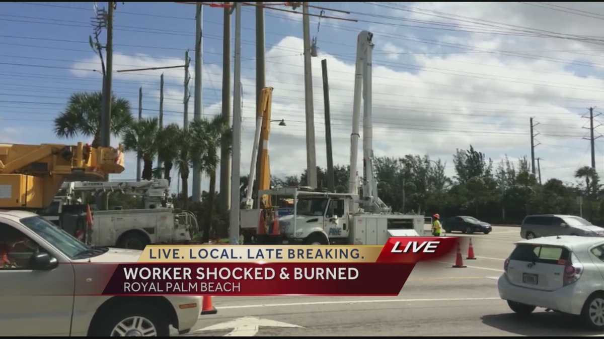 Man shocked, burned working on power line