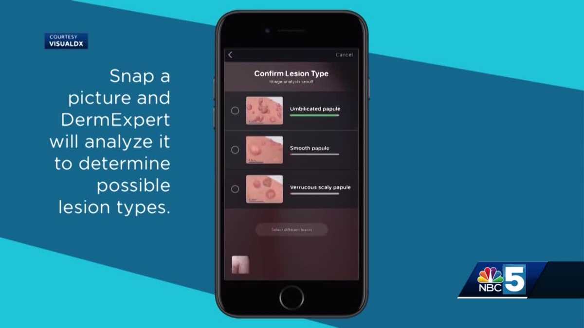 Vermont Department of Health unveils new software expected to improve ...