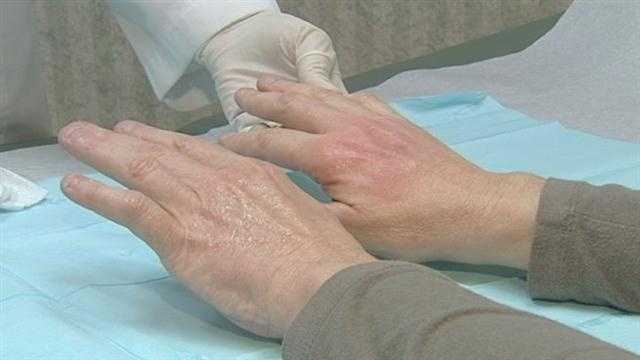 Hand lift making you look younger