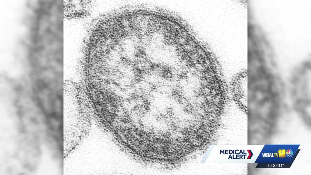 Baltimore doctor explains serious consequences linked to mumps
