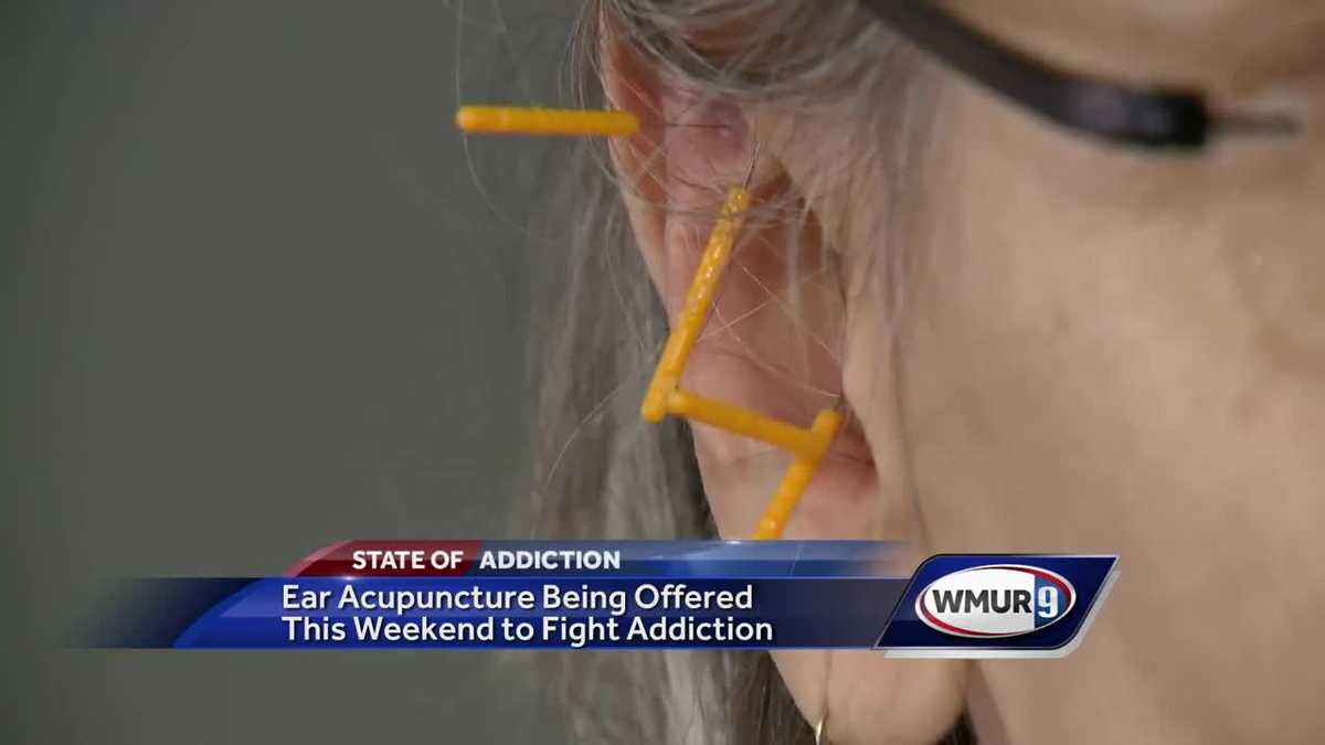 Ear acupuncture for addiction treatment