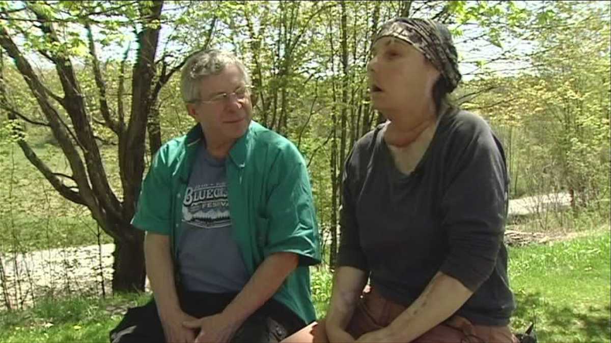 Video: Vt. face transplant patient finds love amid sadness