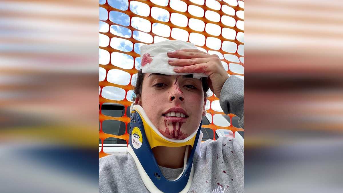 Mass. woman among 25 treated for injuries after MBTA Green Line trolley ...