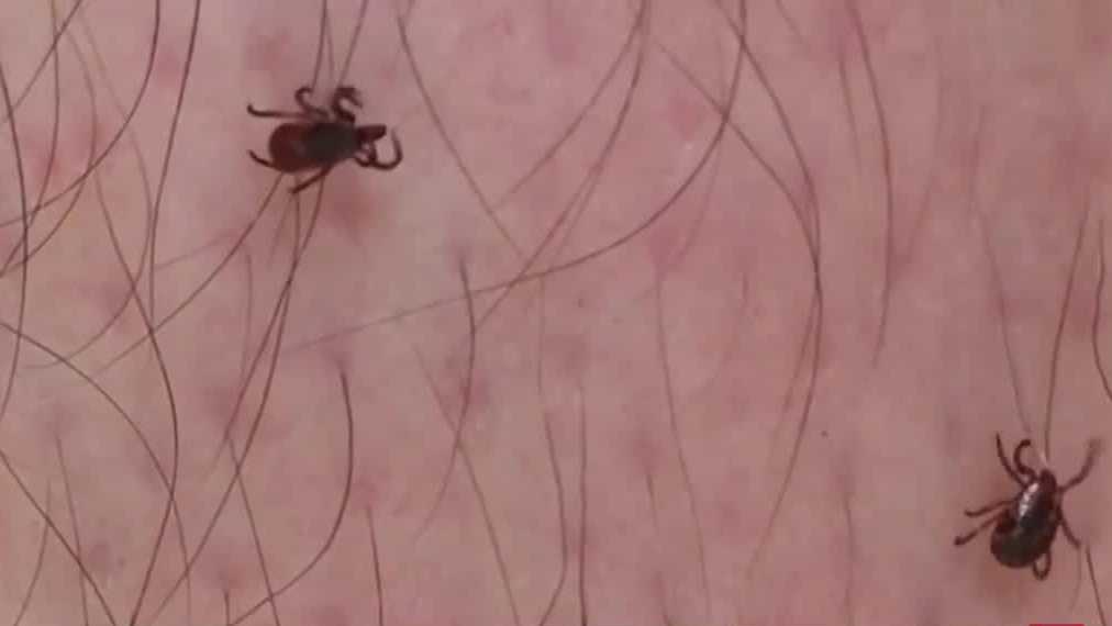 Warmer weather brings out ticks in Massachusetts