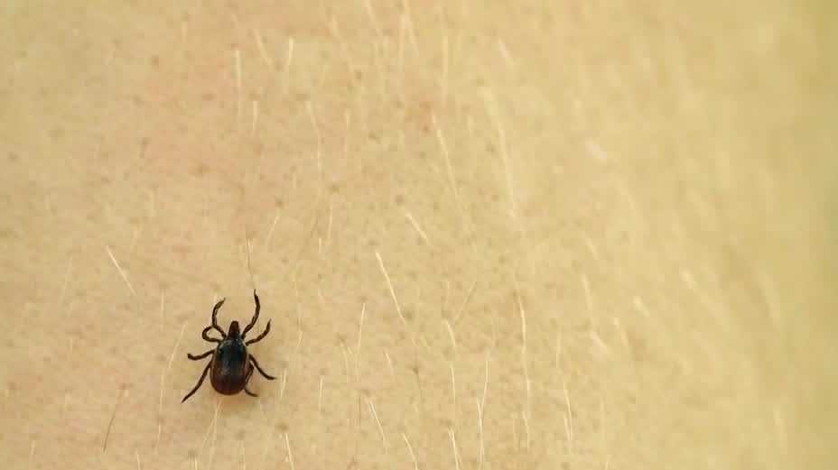 How to protect yourself against ticks this summer
