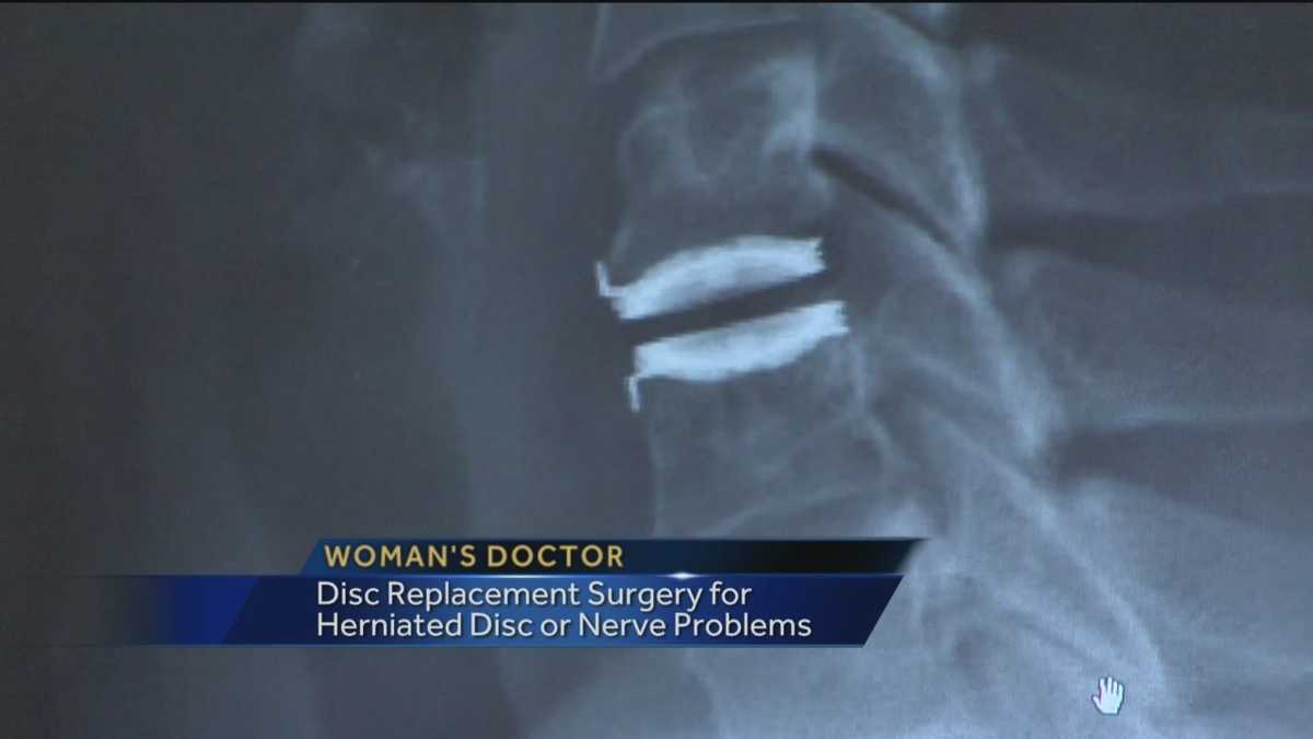Woman's Doctor: Disc Replacement Surgery