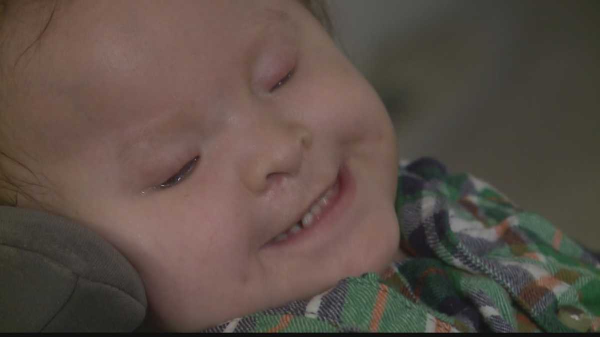 Wisconsin boy born without eyes, ability to hear