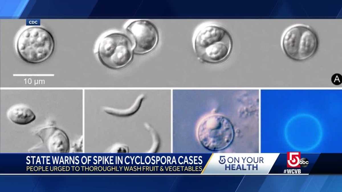 Mass. health officials warn of spike in Cyclospora infection