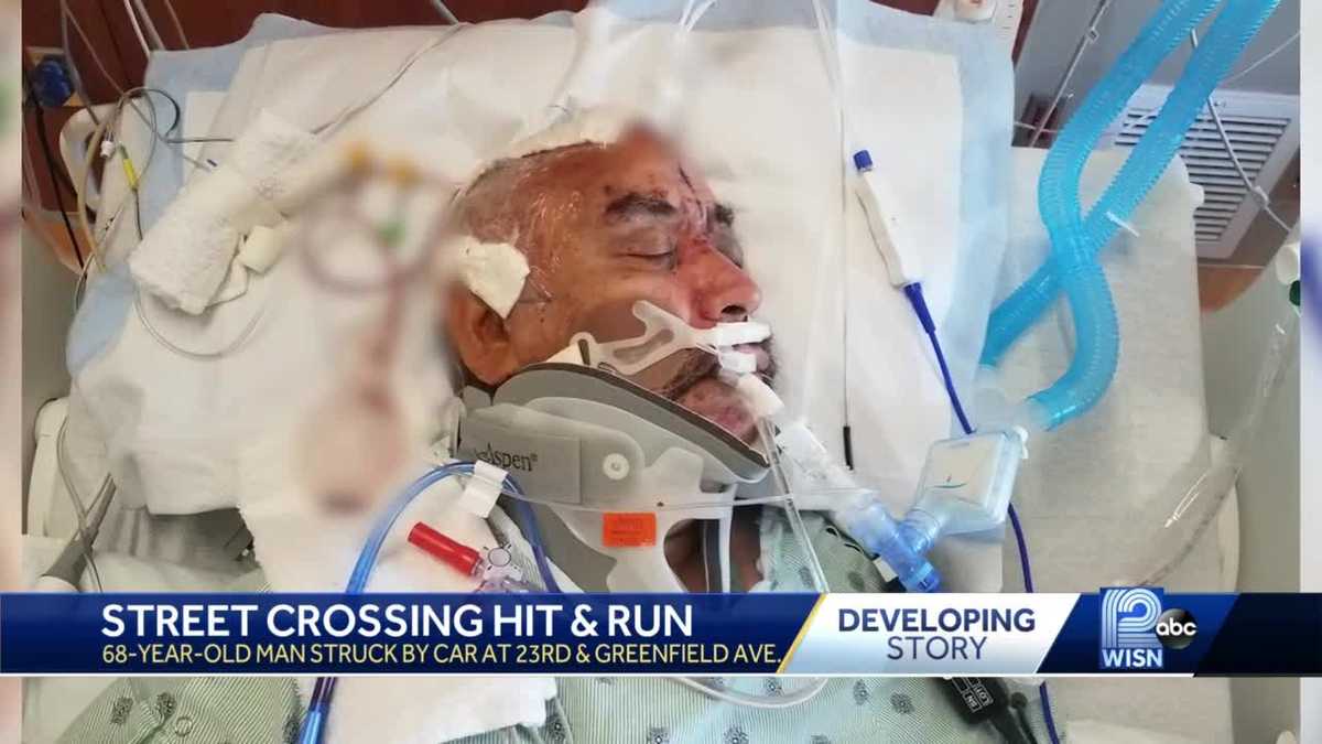 68-year-old man dies 10 days after being hit by driver who did not stop