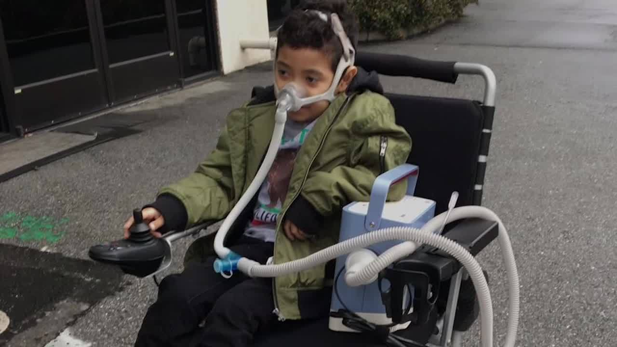 Brother and sister receive rare double-lung transplants