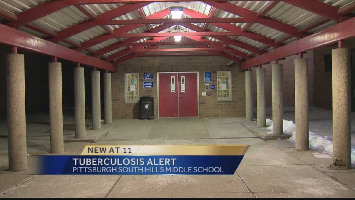 Tuberculosis confirmed in student at Beechview school