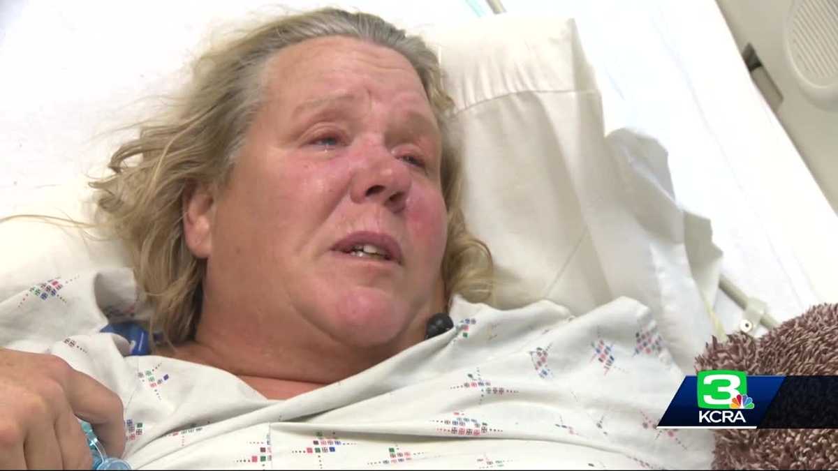 Caltrans contract worker speaks out after I-80 crash injury