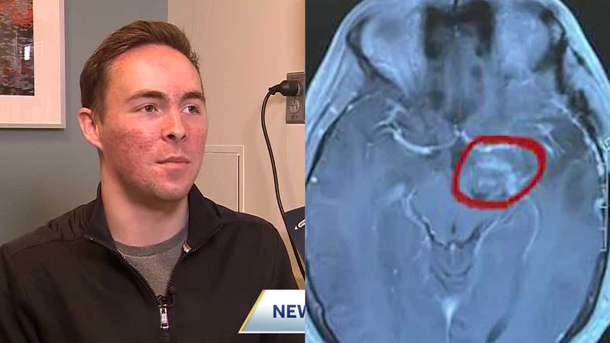 After cancer diagnosis, brain surgeries, Boston University student ...
