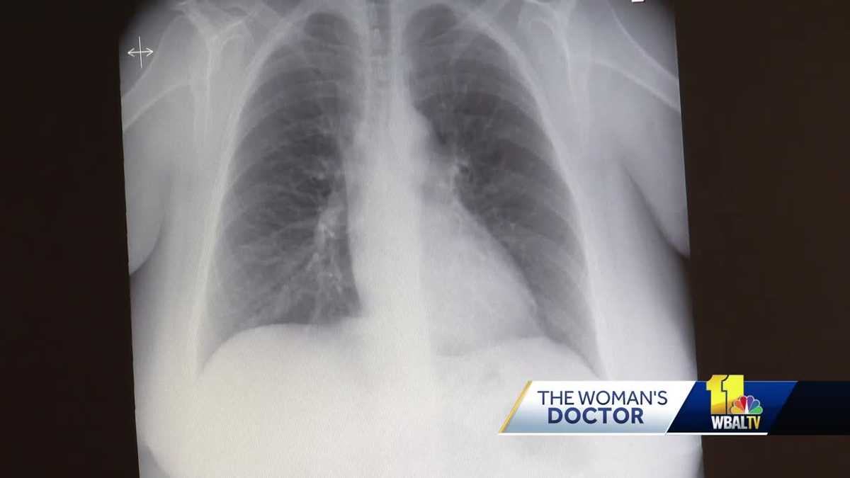 Doctor explains difference between acute, chronic bronchitis