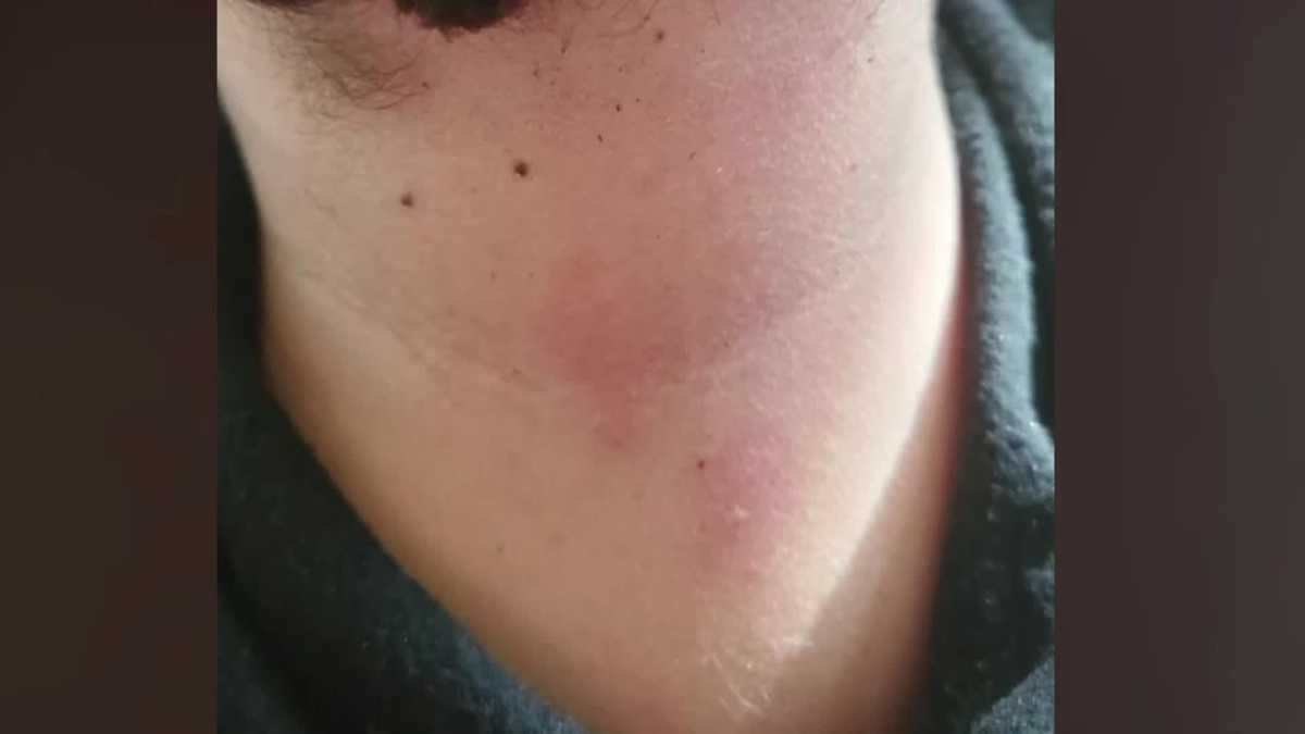 COVID-19: Student says teacher duct taped mask to his face