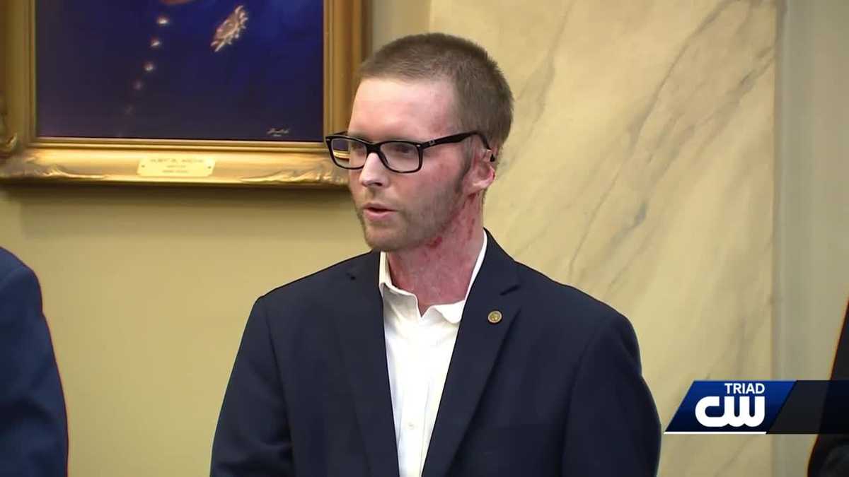 Virginia Councilman Lee Vogler announces return home after brutal attack