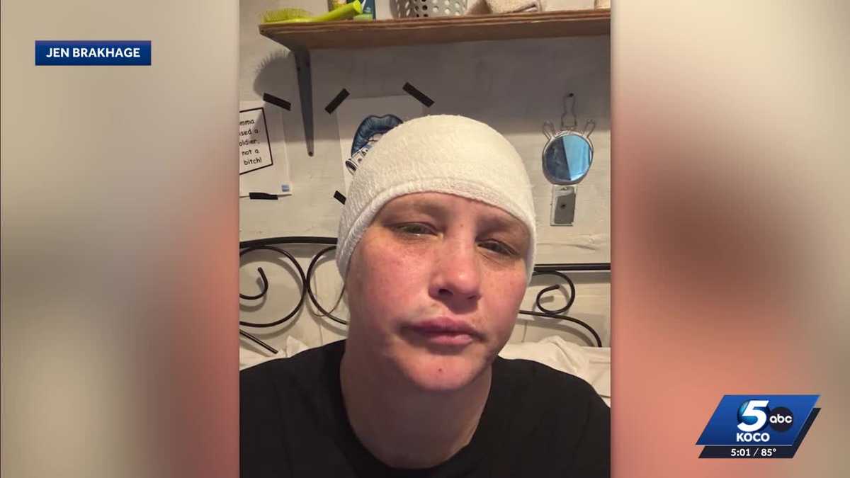 OKC woman letting dog out of home victim of random attack