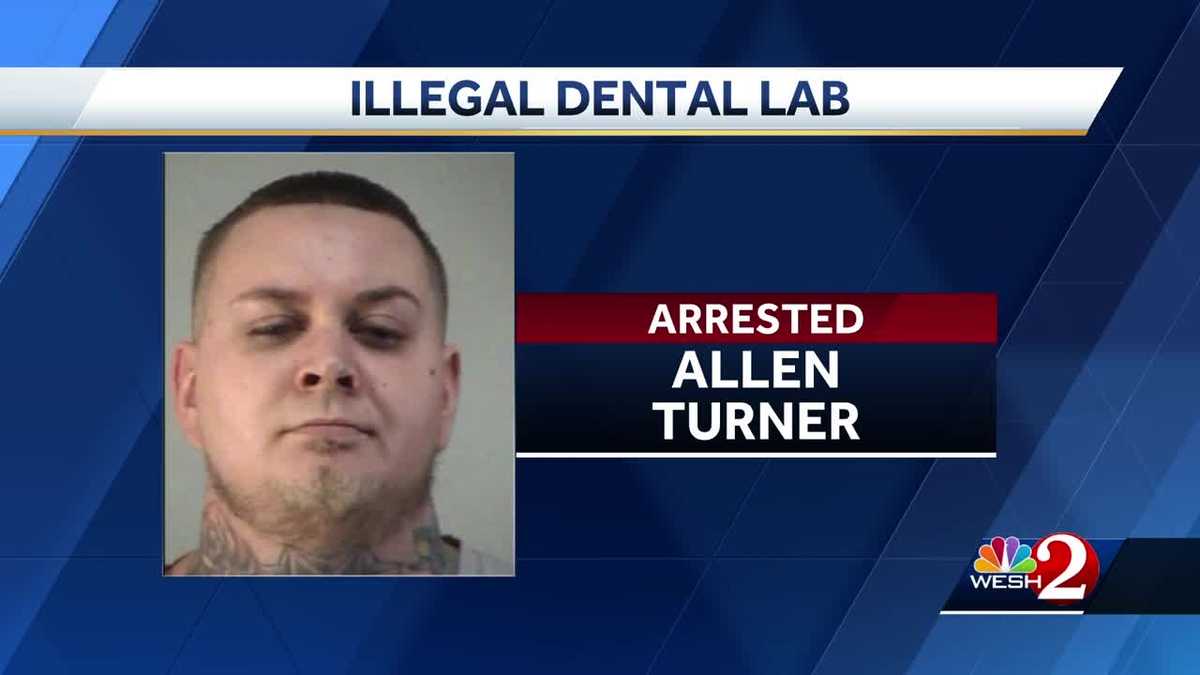 Man Accused Of Operating Illegal Dental Practice