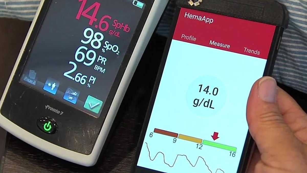 HemaApp Uses Phone Camera to Screen for Anemia